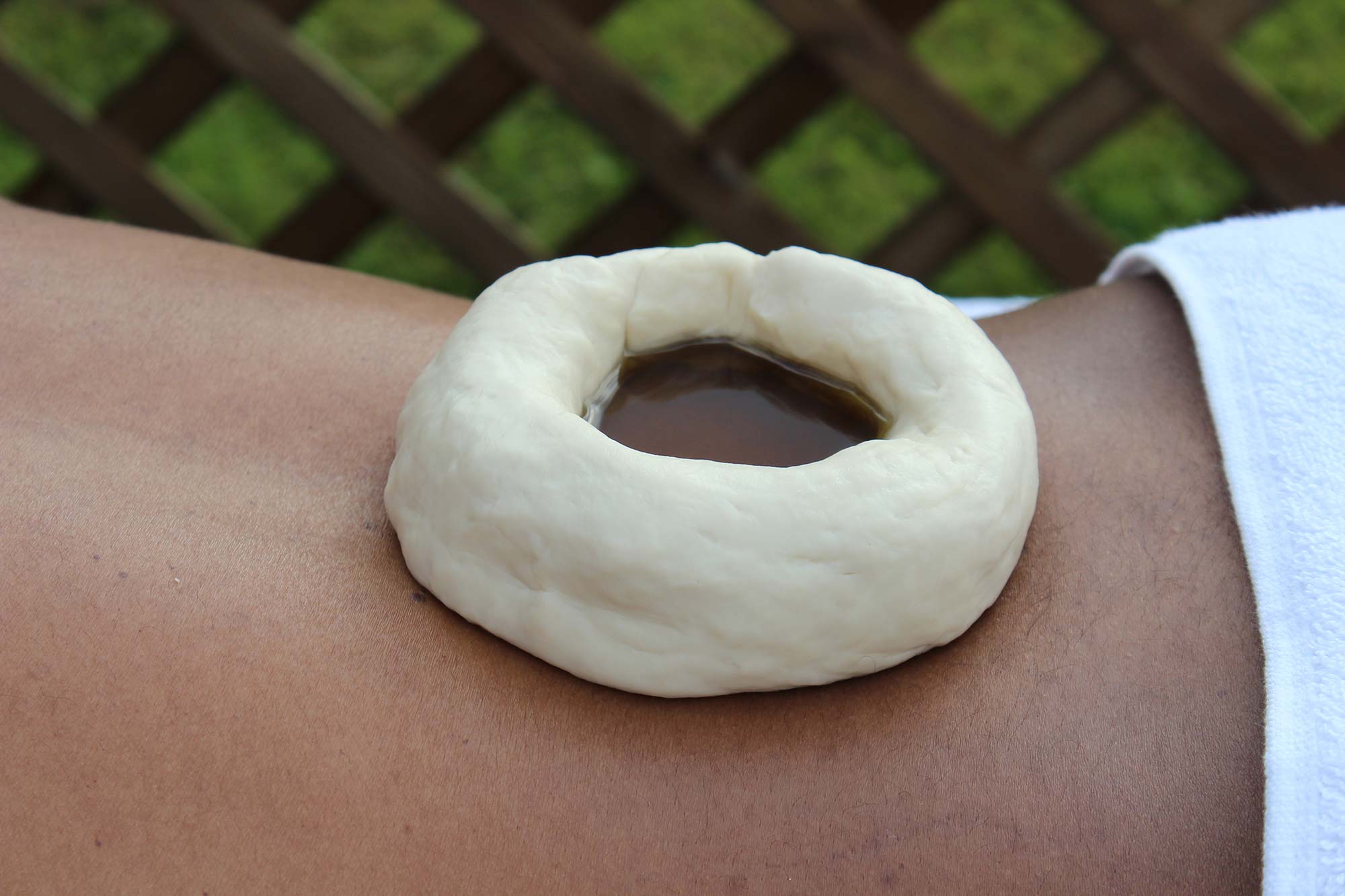 Knee pain Relief -Ayurvedic Janu Basthi in Wetherby near Leeds